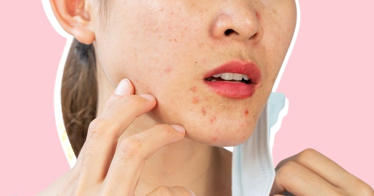Lockdown skin: Dermatologists shares their top tips.